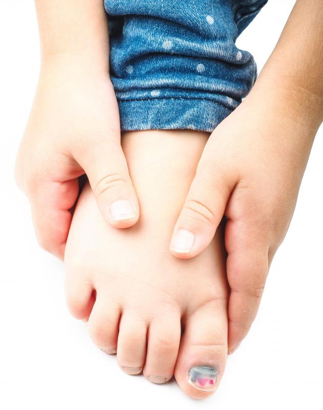 What is a Buffoon? (with pictures)